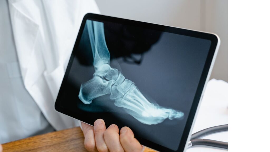 Noha - základ zdraví, síly a stability | Kurz od FyzioFoot