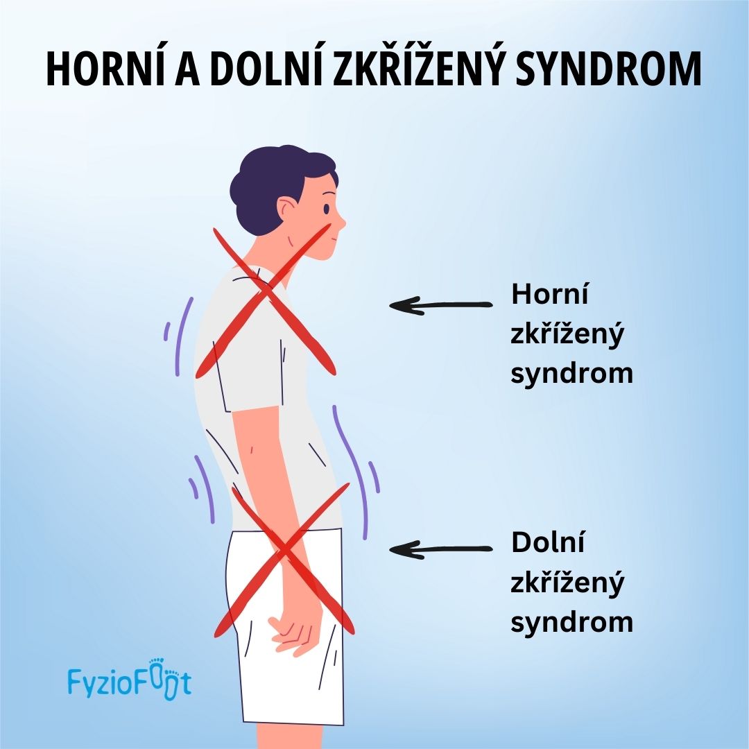Horní a dolní zkřížený syndrom - Jak ho napravit a proč protahování ...